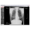 Novarad NovaPACS System - SpectrumXray
