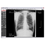 Novarad NovaPACS System - SpectrumXray